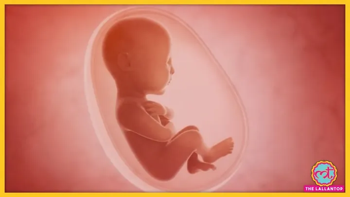 what is fetus in fetu condition?